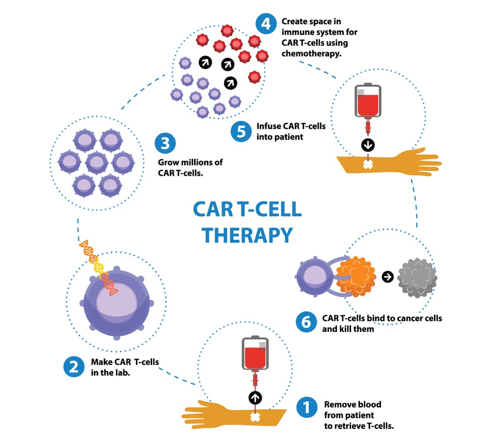 CAR-T Therapy in New York